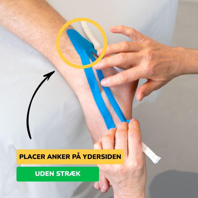 Tape forstuvet ankel med kinesiologi tape | Piece of Tape